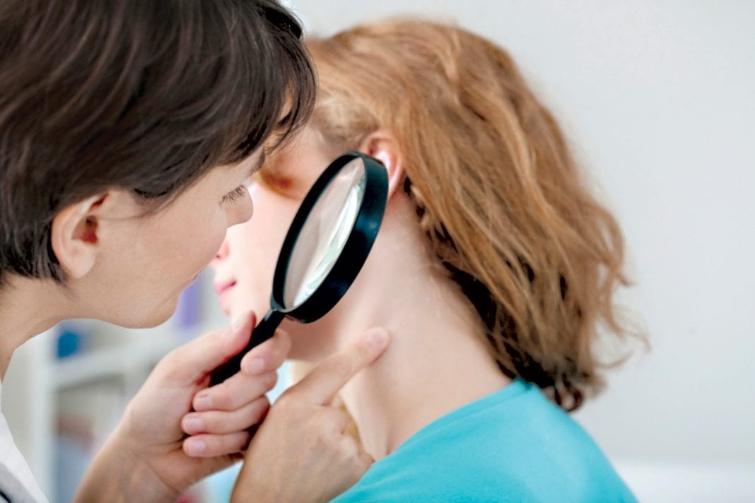 Aterom ili Lojna Cista - Kako Smiriti Upalu Ateroma? - PharmaMedica